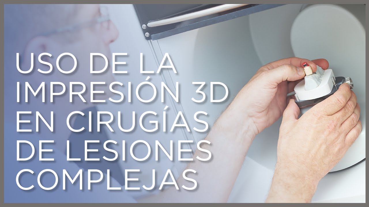 Uso de la impresión 3D en cirugías de lesiones complejas