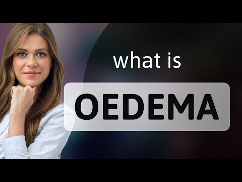 Oedema • what is OEDEMA meaning