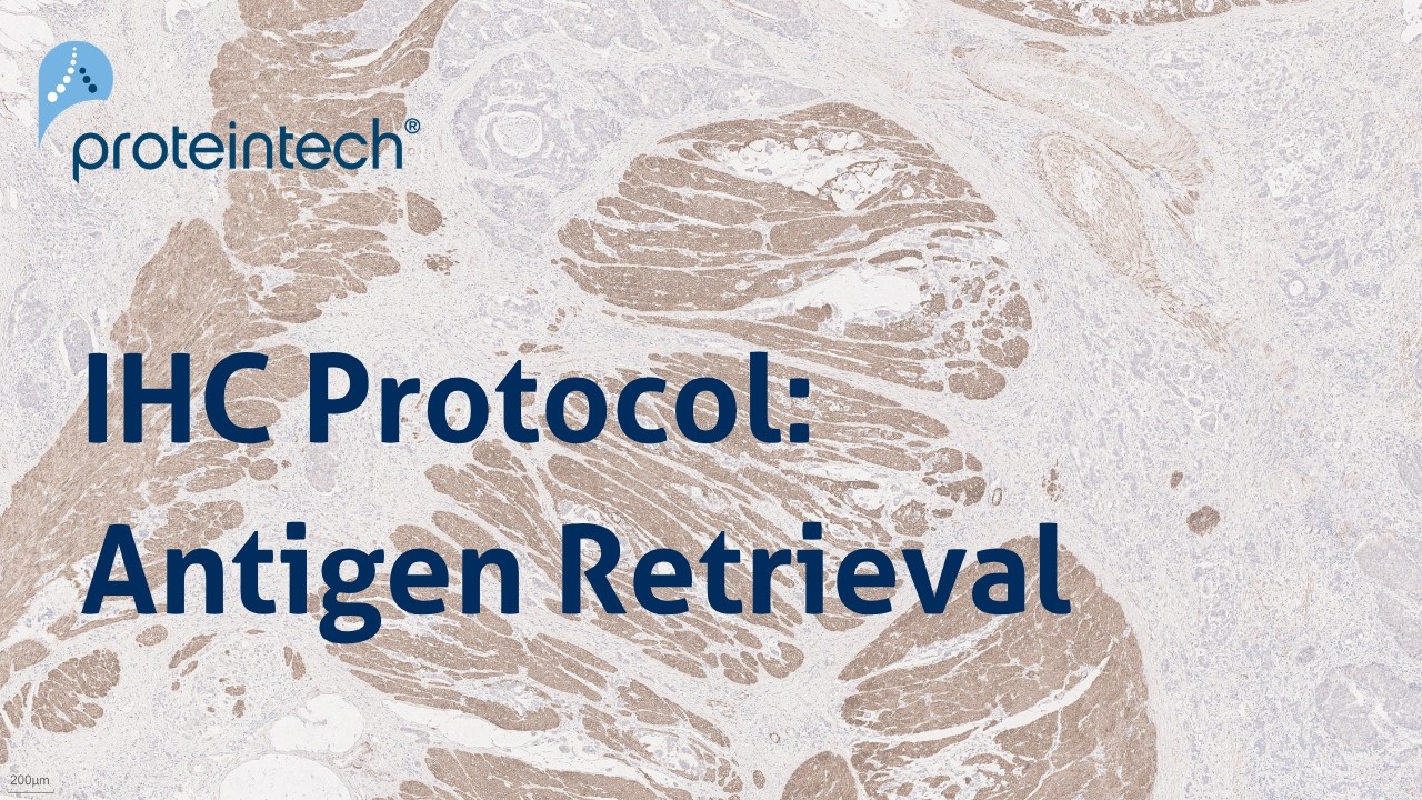 Immunohistochemistry (IHC): Antigen Retrieval