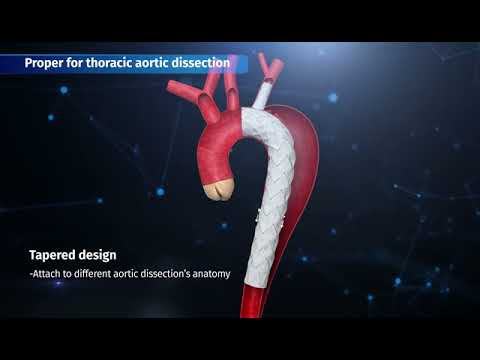 Castor Branched Aortic Stent Graft System