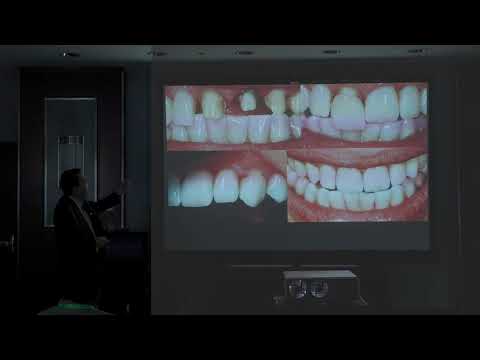 LMT 2023 Chicago - Luke Kang - Full Mouth Cases: Color and Contour Precision