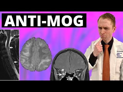 MOGAD (Myelin Oligodendrocyte Glycoprotein Associated Disease) Explained by Neurologist