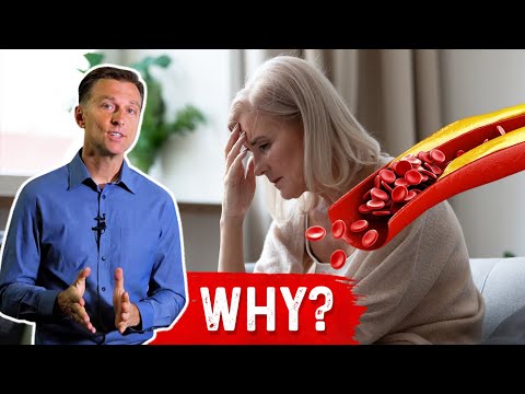 High Cholesterol After Menopause?