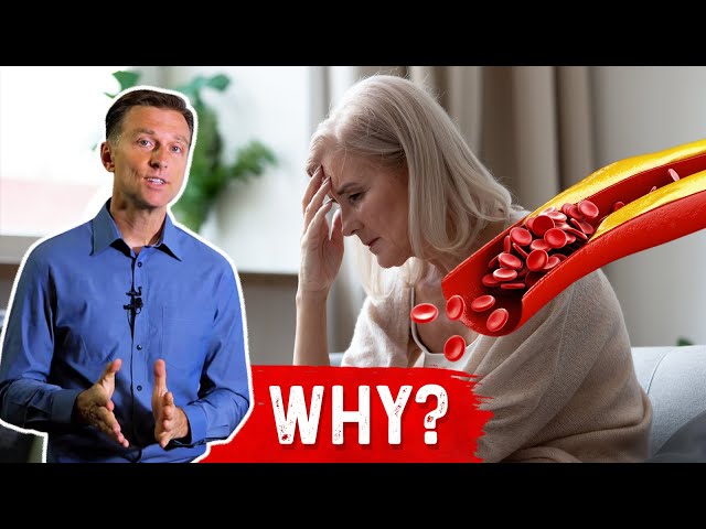 Understanding Cholesterol Changes After Menopause | Galaxy.ai