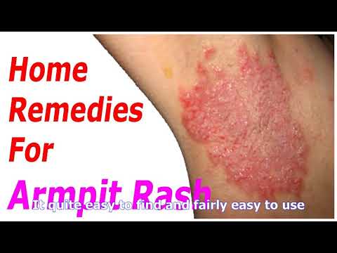 Ten ways to eliminate armpit rash | what health tips
