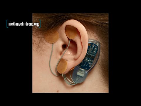 Are There Alternatives to Medication for IBS? - Dr. Heidi Gamboa Discusses the IB-STIM Device