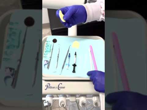 Dental Sealants