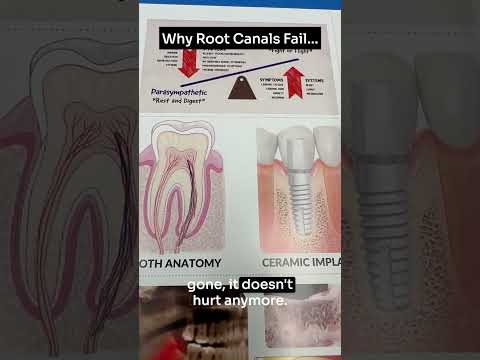 Why Root Canals Fail. #shorts