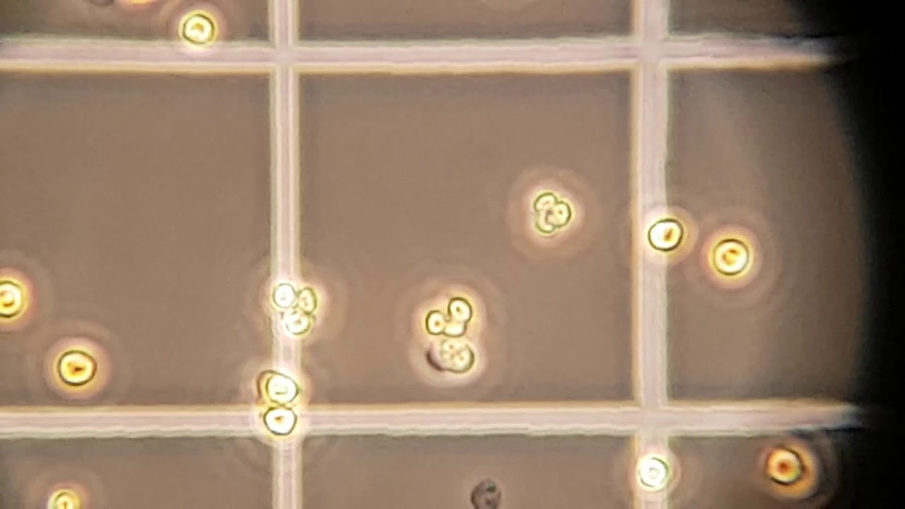 Chlorella au microscope