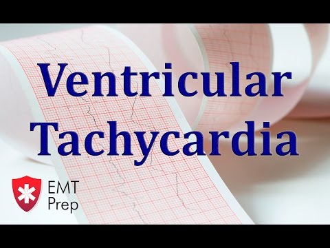 Ventricular Tachycardia ECG - EMTprep.com