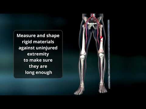 Splinting in the Tactical Environment