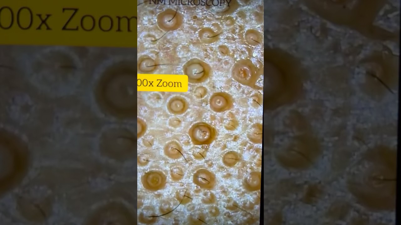 White heads under microscope. Click more for link to original