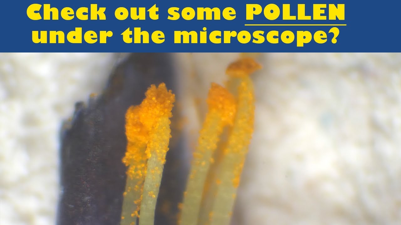 Dude with a Microscope: Pollen!