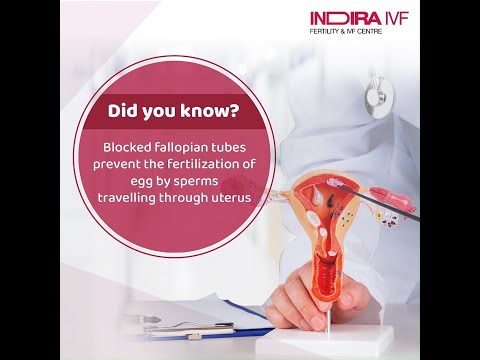 How does HSG test help detect Blocked Fallopian tubes