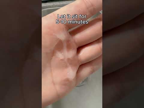 Tough calluses from lifting? 💪