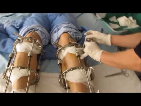 Pin Site Care