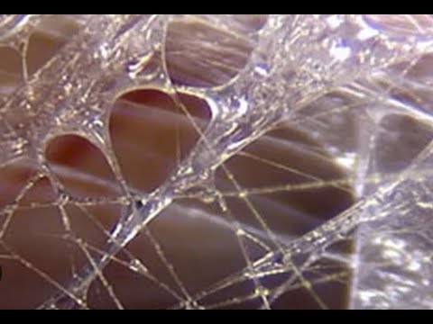 TRAILER - Dr JC Guimberteau Interviewed by Dr Chikly: Organization of the Fascia of the Dermis.
