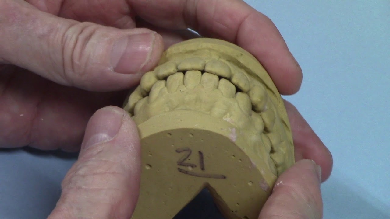 Hawley Retainer Considerations