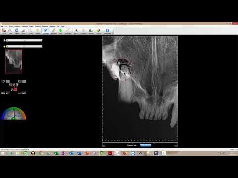 CDR software tutorial for vets