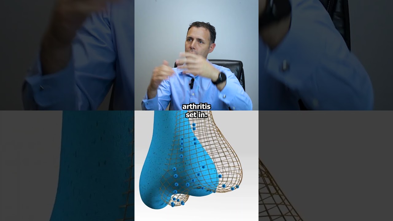 Kinematic Alignment vs Mechanical Alignment | Steven Stoker, DO