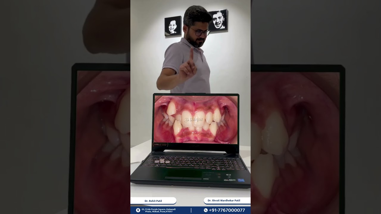 Goodbye crooked teeth, hello stunning smile!