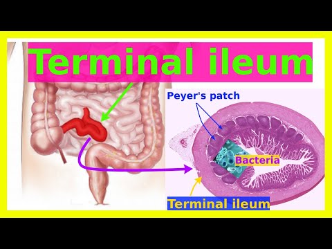 terminal ileum