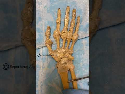 Tendons of phalanges