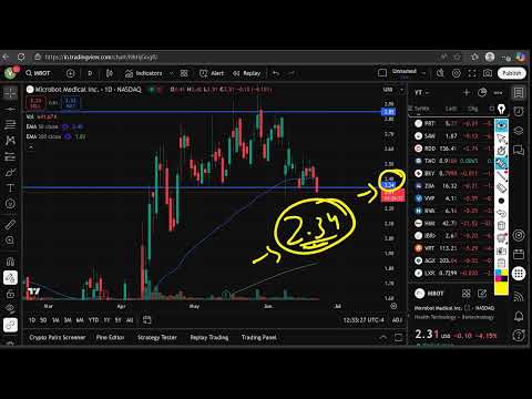 MBOT Stock (Microbot Medical stock analysis) MBOT STOCK PREDICTION MBOT STOCK analysis MBOT stock