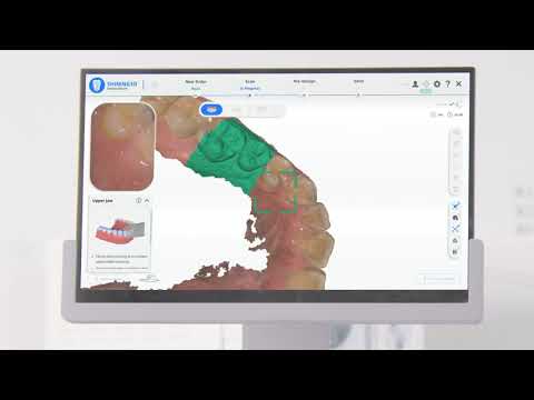 Shining 3D Aoralscan 3: Scan Procedure