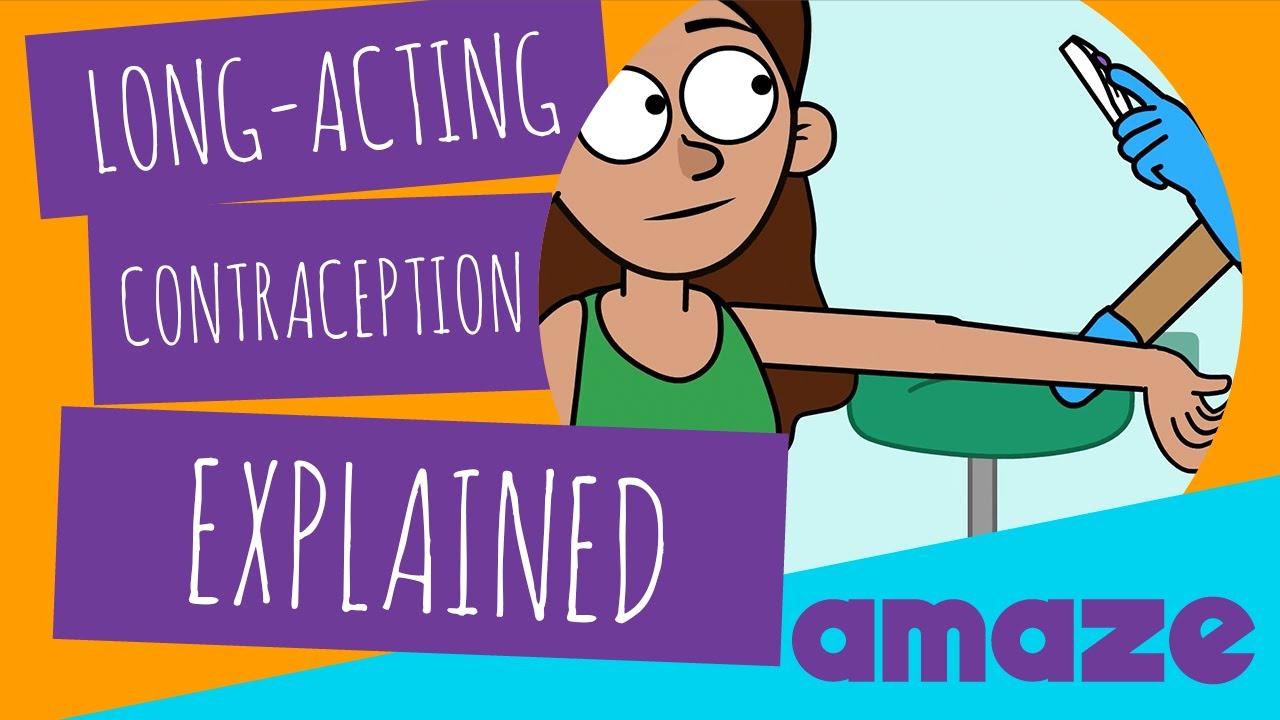 Long-Acting Contraception Explained