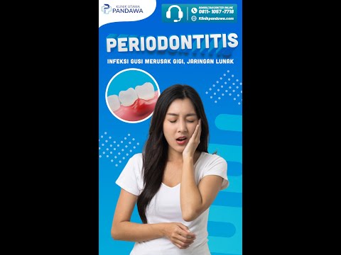 Periodontitis | Infeksi Gusi | Merusak Gigi, Jaringan Lunak #shortsvideo #shorts