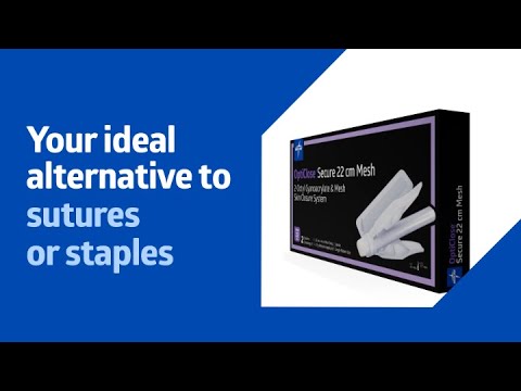 OptiClose Secure - Your Answer to Safe and Effective Wound Closure