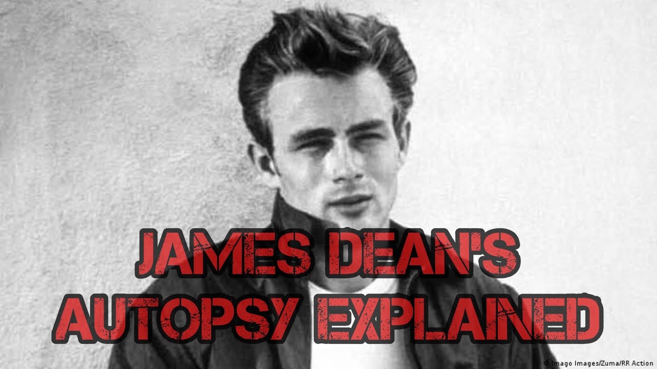 Famous Autopsies- James Dean