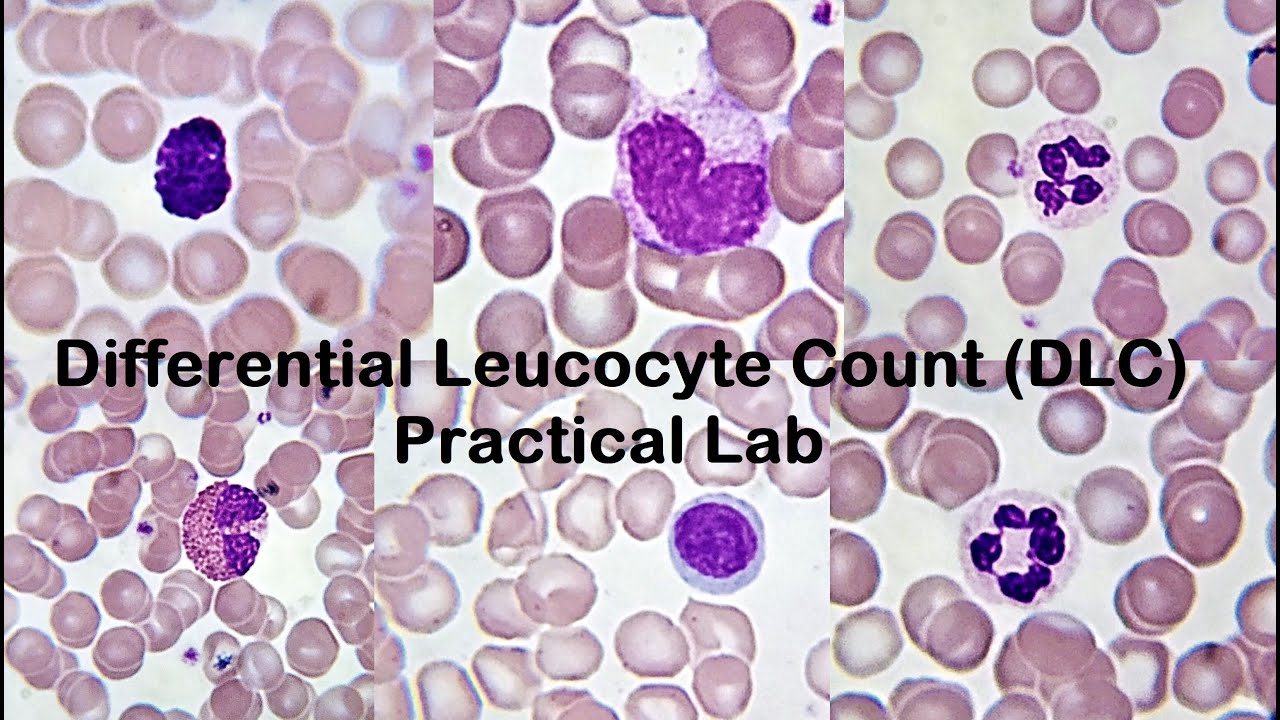 Differential Leucocyte Count DLC Practical Lab