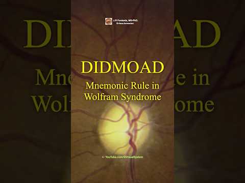 Wolfram Syndrome. DIDMOAD, Mnemonic Rule.