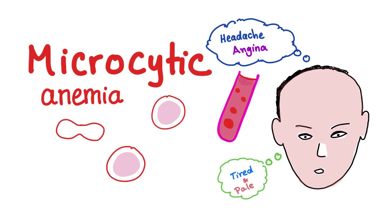 Microcytic Anemia introduction