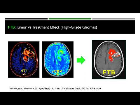 Advanced MRI Measurements of Brain Tumors