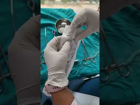 Insertion of an IUCD