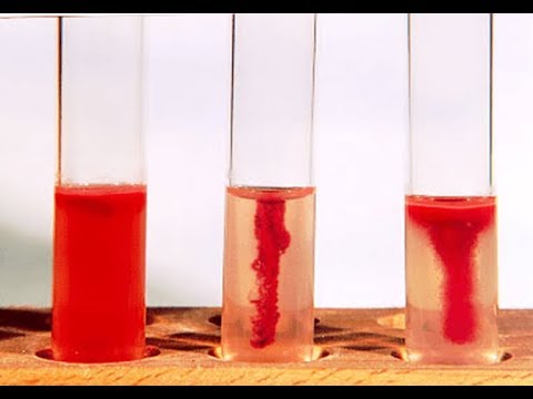 Microbiology of Motility