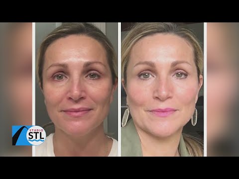 Medspa Monday with Face & Body: Fuzion in South County offers medically supervised injectables