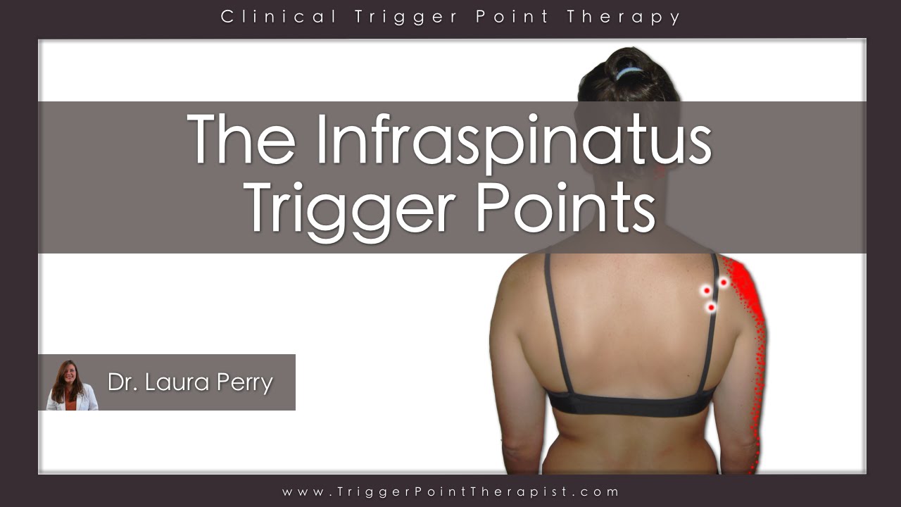The Infraspinatus Trigger Points