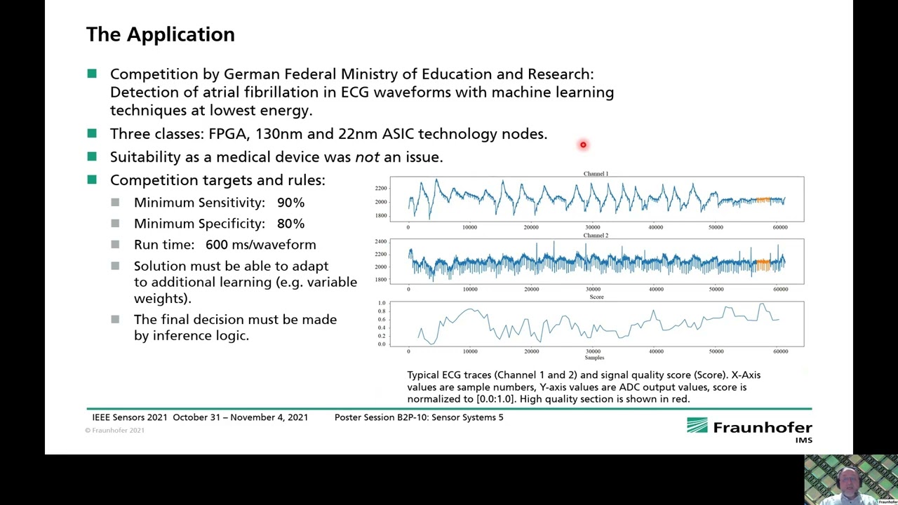 Design of an Artificial Neural Network Circuit for Detecting Atrial Fibrillation in ECG Signals