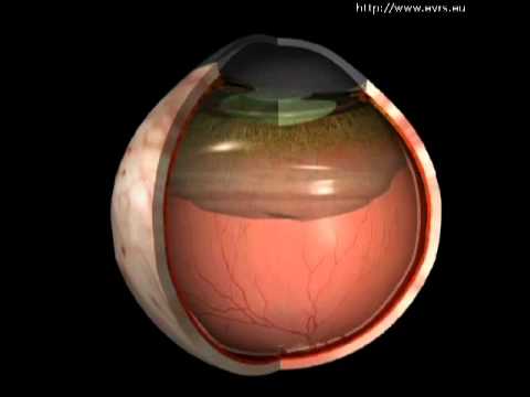 Posterior-Vitreous-Detachment - evrs