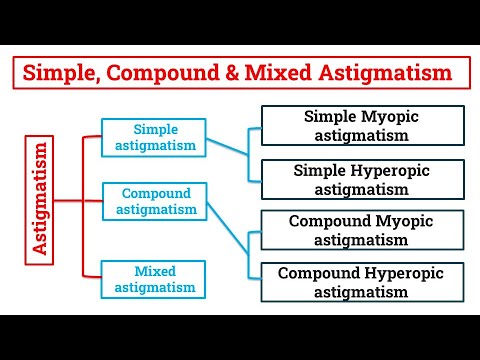 Simple, Compound & Mixed Astigmatism- Complete Tutorial
