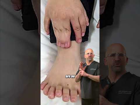 More Common Fingers & Toes Issue Than Most Realize #shorts