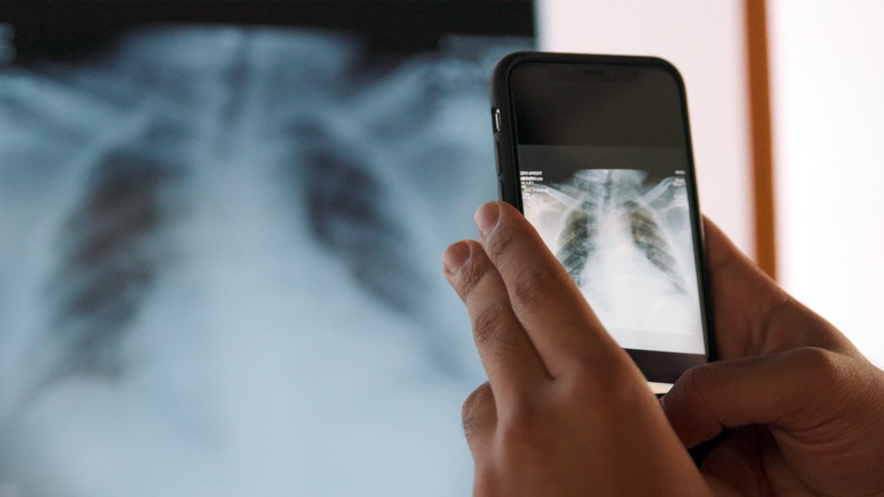 Stanford researchers create algorithm to interpret chest x-rays