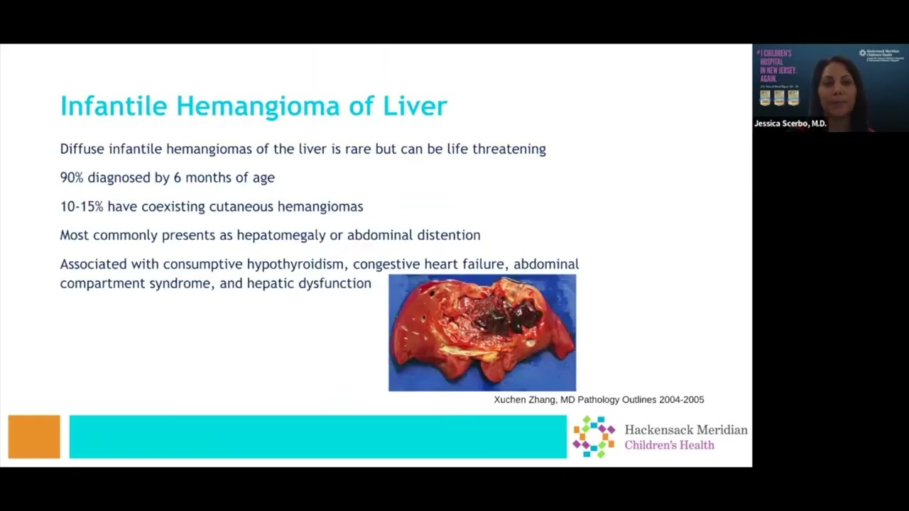 Vascular Anomalies in Children: Beyond the Birthmark | HMH