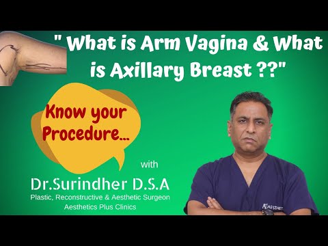 What is Axillary Breast & What is Arm Vagina? DrSurindher explains. #aestheticsplusclinics