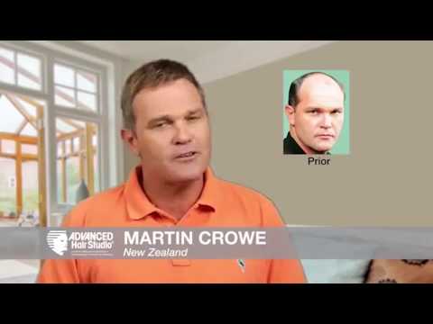 Real People, Real Hair Loss Stories' by Advanced Hair Studio's clients