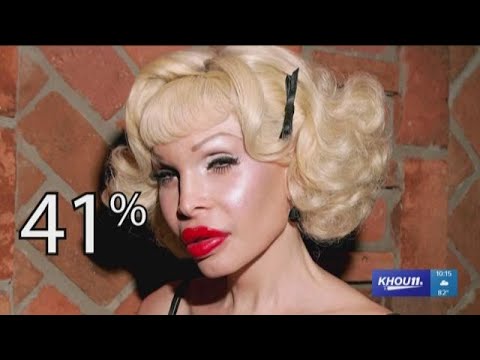 Plastic surgery by the numbers
